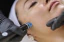 Elase Med Spa Florida | Aesthetics & Wellness Treatments