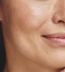 Med Spa Florida Locations | Elase